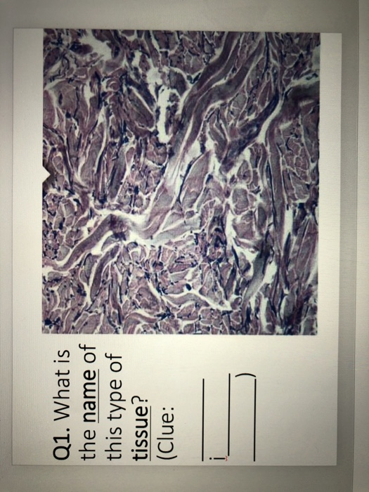 Solved Q1. What is the name of this type of tissue? (Clue: | Chegg.com