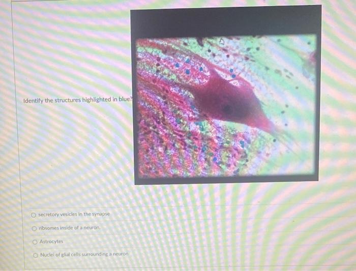 Solved Identify the structures highlighted in blue? | Chegg.com