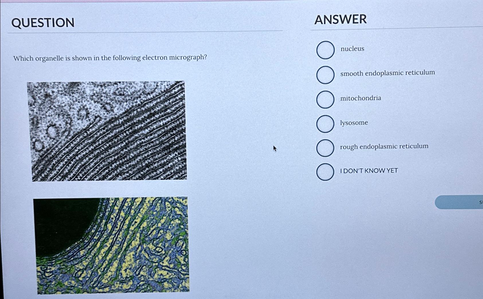 Solved QUESTIONANSWERWhich organelle is shown in the | Chegg.com