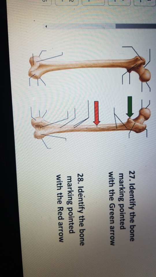 Solved 24. Identify the bone 25. Identify the bone marking | Chegg.com