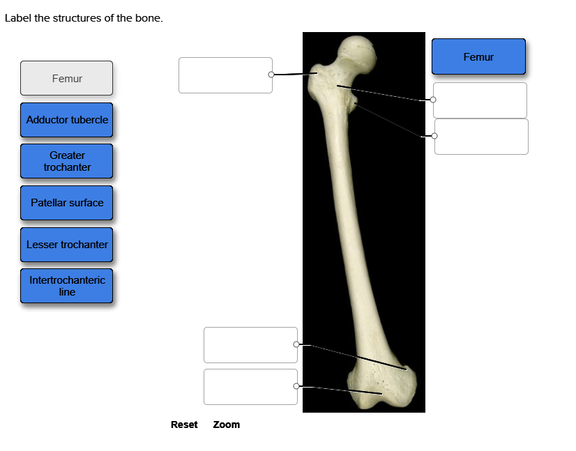Solved Label the structures of the bone. | Chegg.com