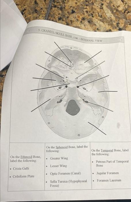 Solved 4 CALVARIA-SKULL EXTERNAL Temporal Bone - Squamous | Chegg.com