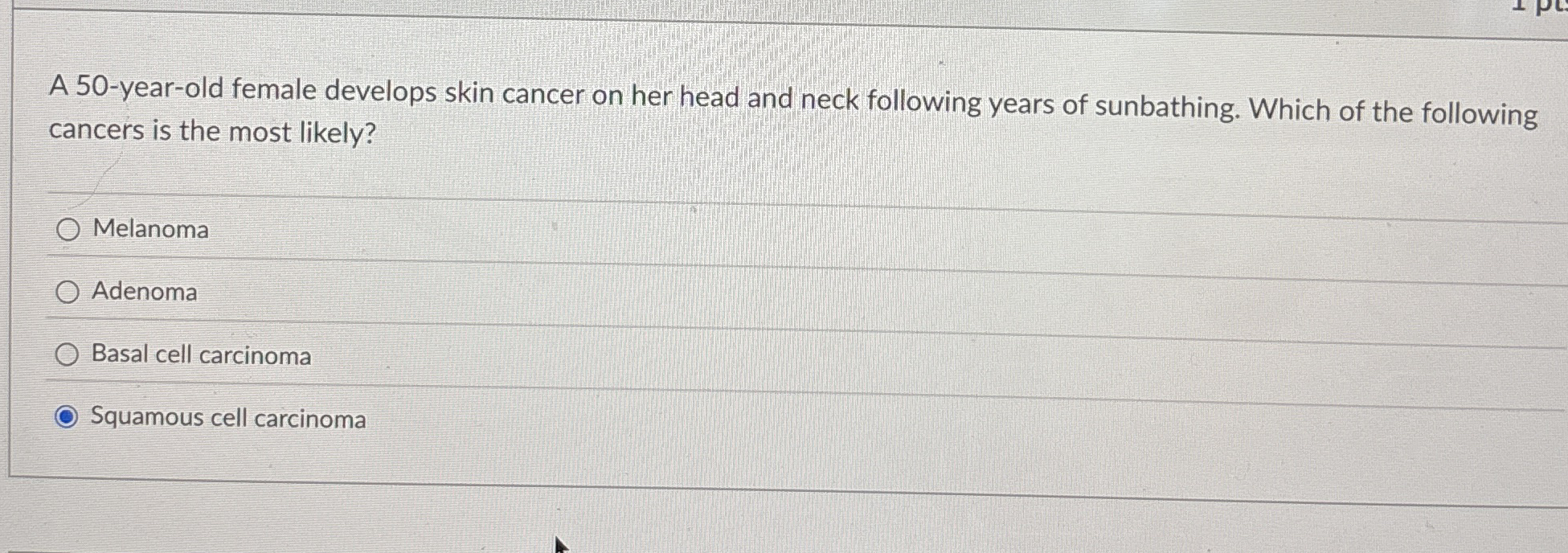 Solved A 50-year-old female develops skin cancer on her head | Chegg.com