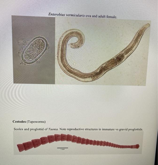 Solved Helminth is a general term used to describe an | Chegg.com
