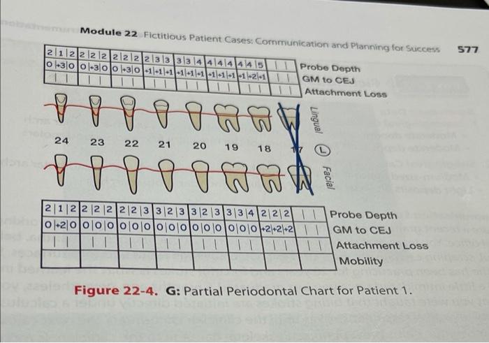 Solved 574 Fundamentals of Periodontal Instrumentation & | Chegg.com