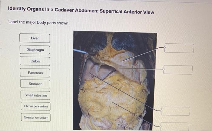 Solved Identify Organs In a Cadaver Abdomen: Superfical | Chegg.com