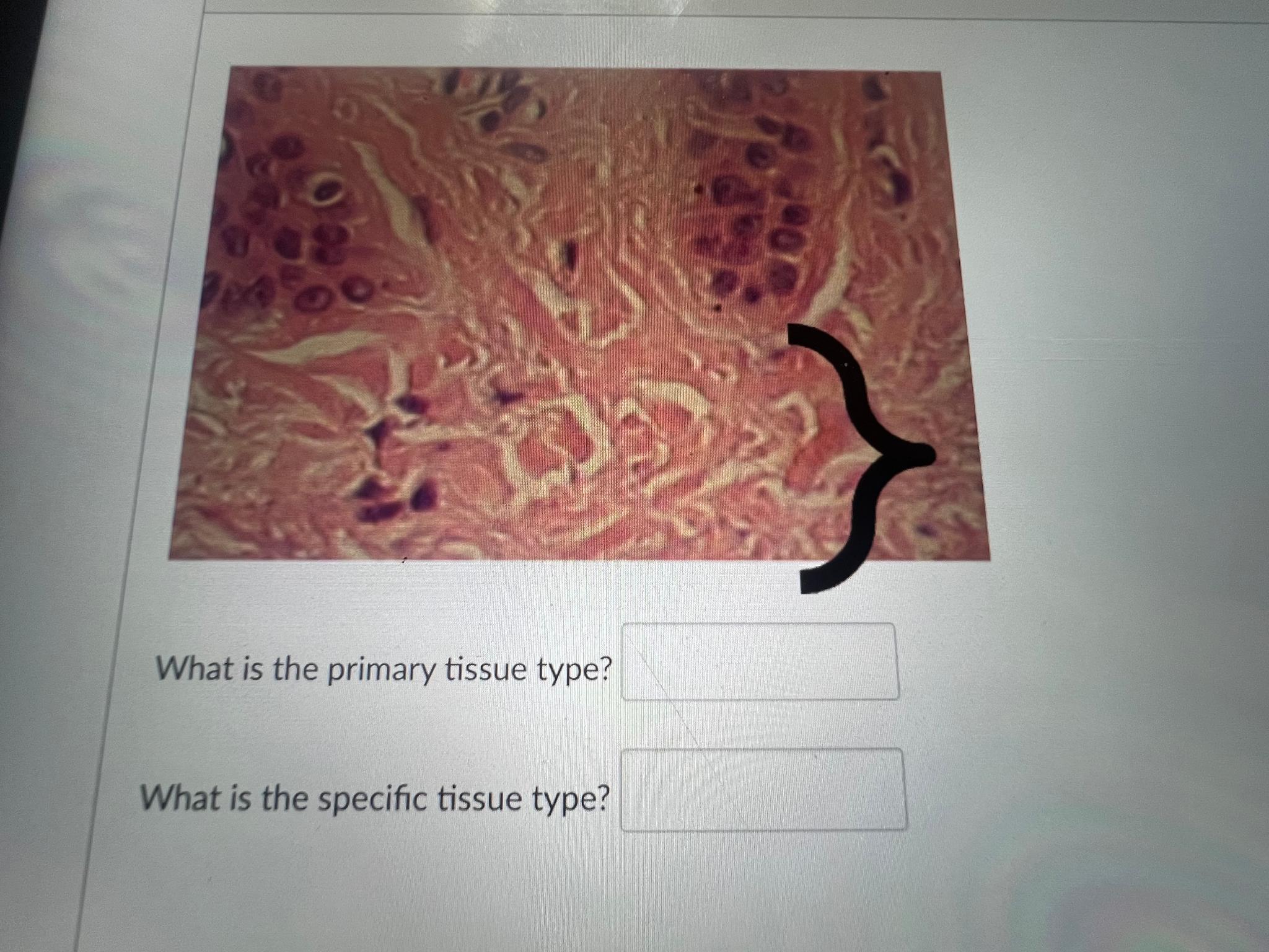 Solved What is the primary tissue type?What is the specific | Chegg.com