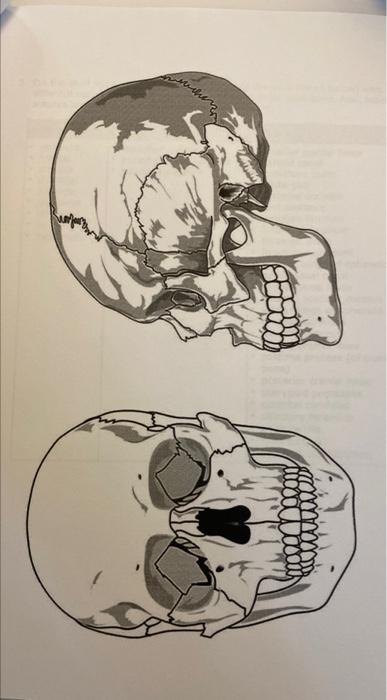 On the skull diagrams below, color the bones of the | Chegg.com