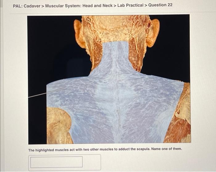Solved PAL: Cadaver > Muscular System: Head and Neck > Lab | Chegg.com