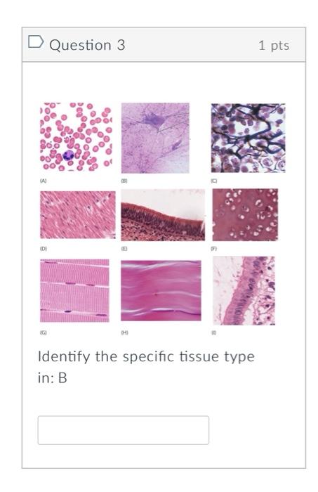 Solved Question 3 1 Identify the specific tissue type in: B | Chegg.com