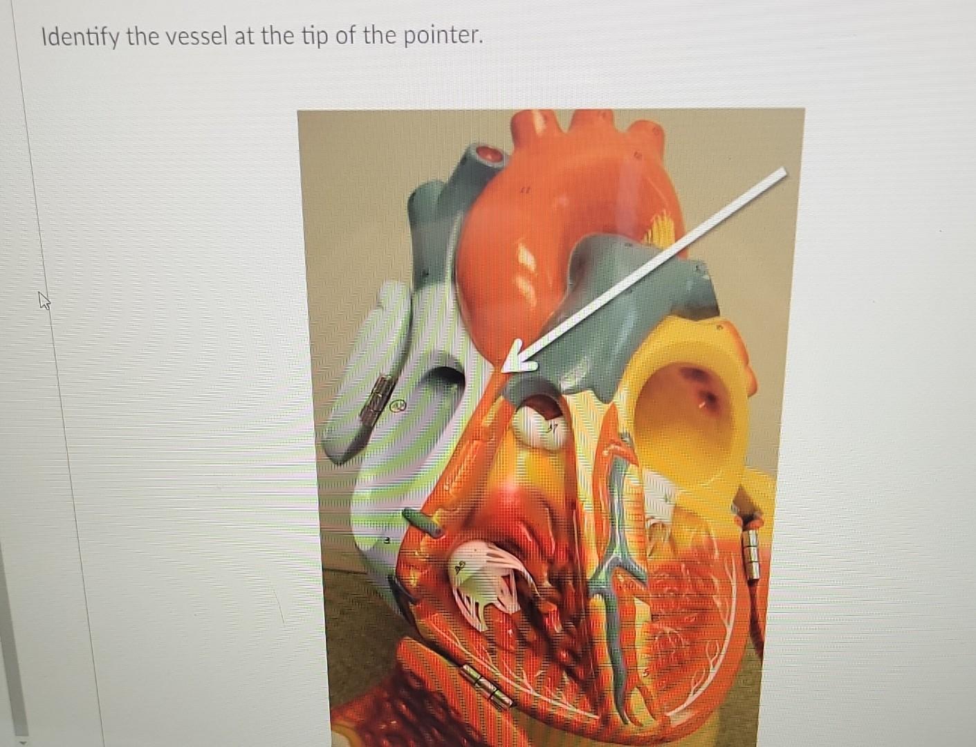 Solved dentify the structure at the tip of the | Chegg.com