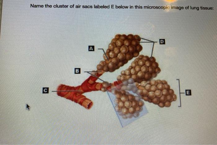 Solved Name the cluster of air sacs labeled E below in this | Chegg.com