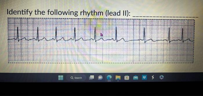 Solved Identify the following rhythm (lead II): | Chegg.com