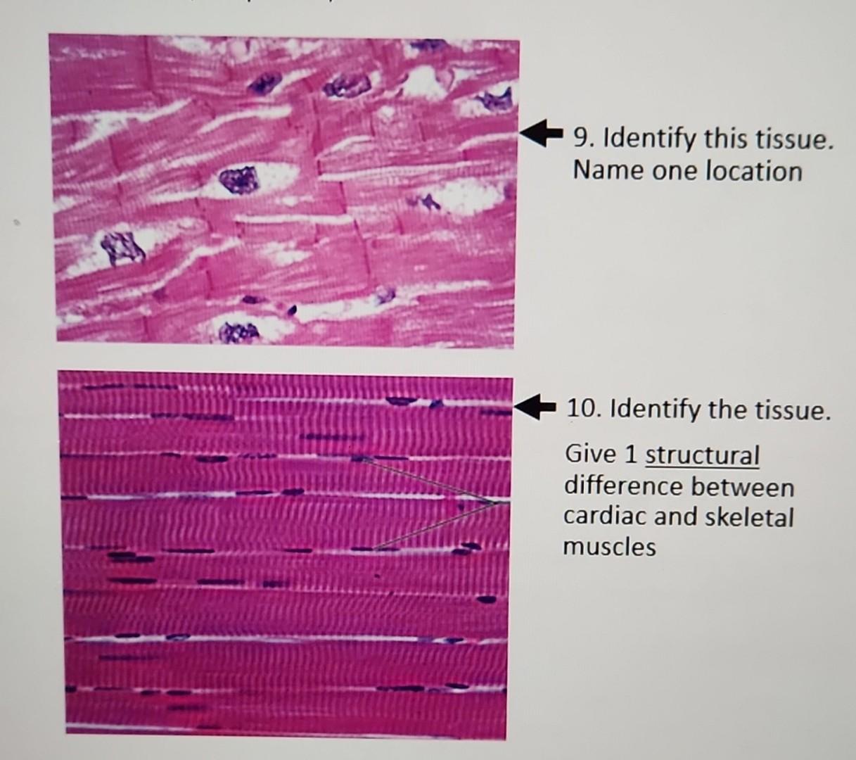 Solved 7. Identify this tissue. Give one location 8. | Chegg.com