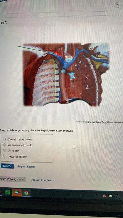 Solved art A Free Teat From which larger artery does the | Chegg.com
