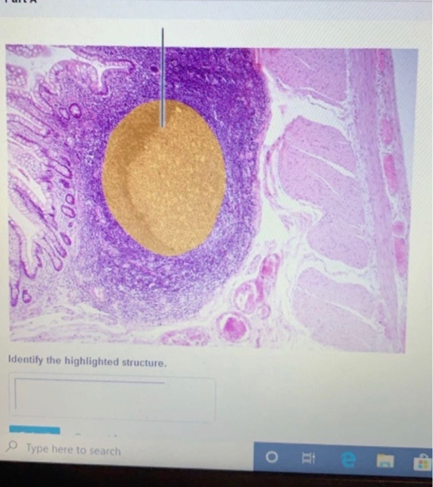Solved Identify the highlighted structure. Type here to | Chegg.com