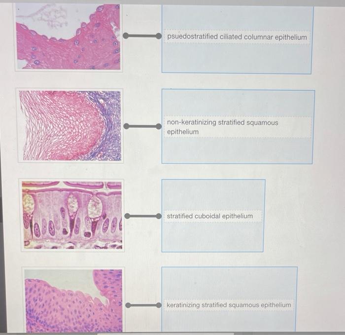 Solved TE simple columnar epithelium simple squamous | Chegg.com