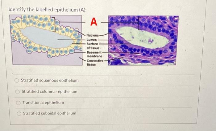 Solved Identify the labelled epithelium (A): Simple cuboidal | Chegg.com