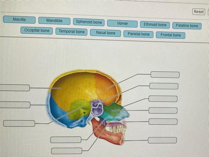 Solved Reset Maxilla Mandible Sphenoid Bone Vomer Ethmoid