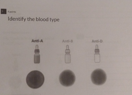 Solved 74 ﻿pointsIdentify the blood typeAnti-AAnti-8Anti-D | Chegg.com