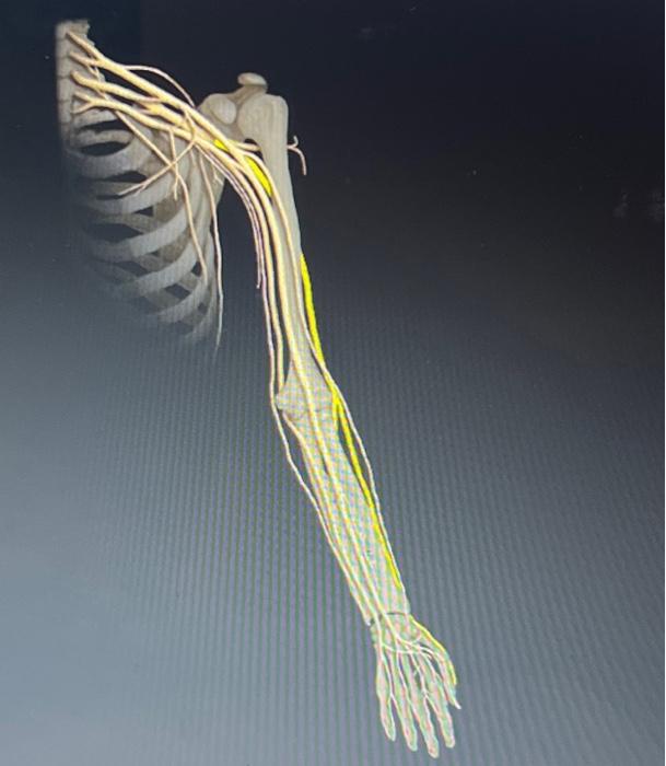 Solved What structure is highlighted? A. Axillary n. B. | Chegg.com