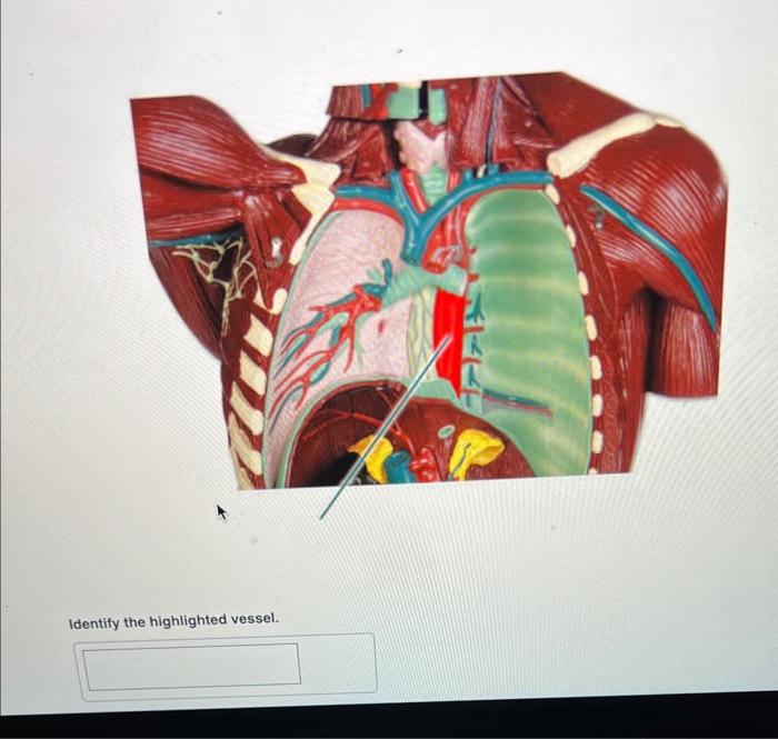 Solved Identify the highlighted vessel. eneify the | Chegg.com