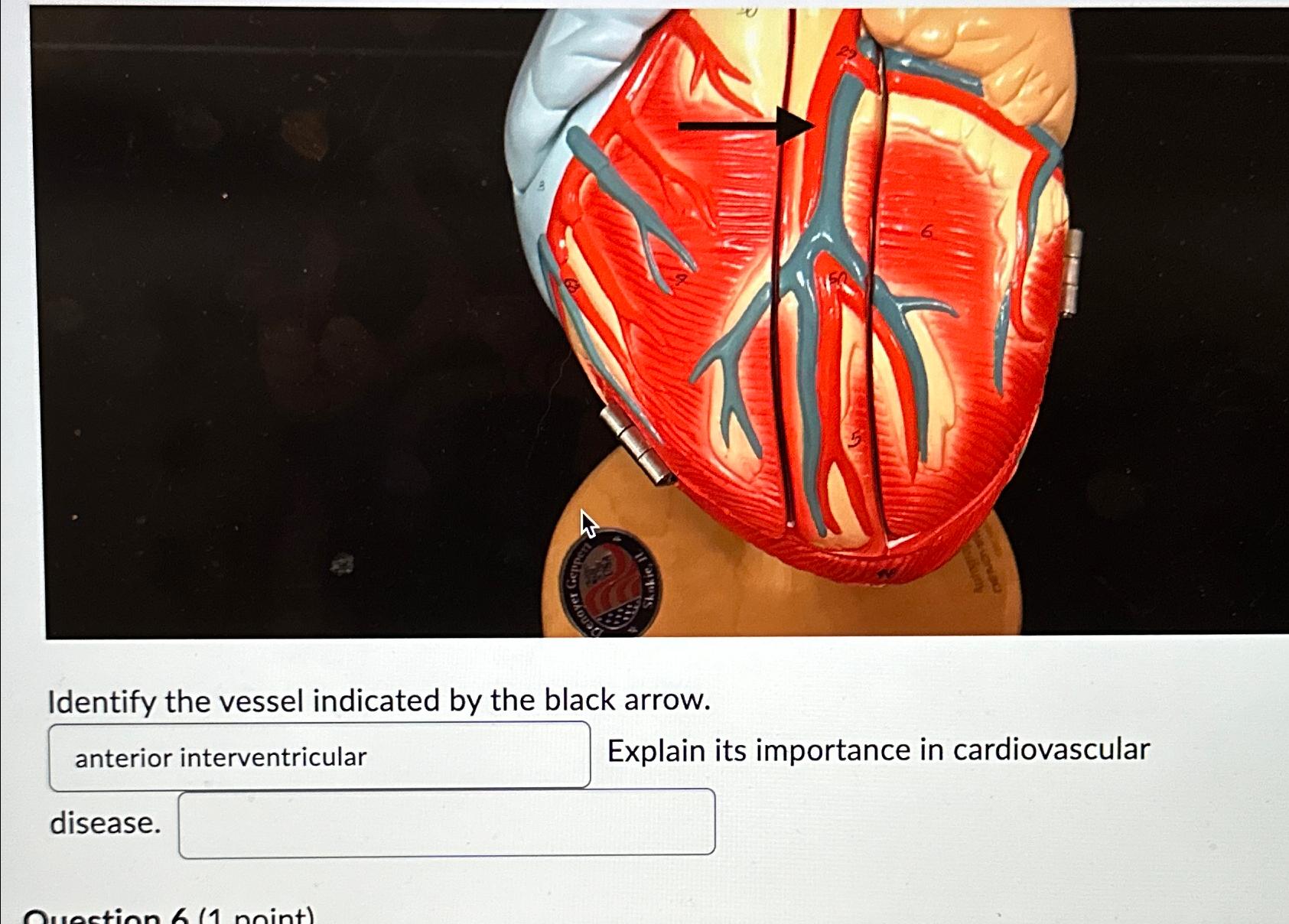 Solved Identify the vessel indicated by the black | Chegg.com