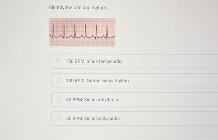 Solved Identify the rate and rhythm. ليليليليليل O 150 BPM; | Chegg.com