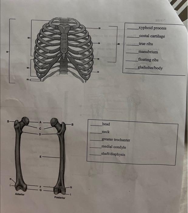 Solved xyphoid process costal cartilage true ribs manubrium | Chegg.com