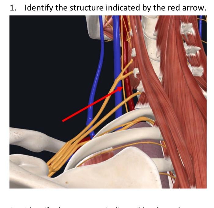 Solved 1. Identify the structure indicated by the red arrow. | Chegg.com