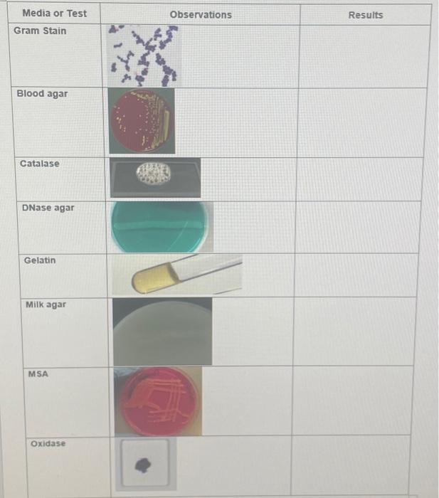 Solved what is the unknown bacteria and find out which is | Chegg.com