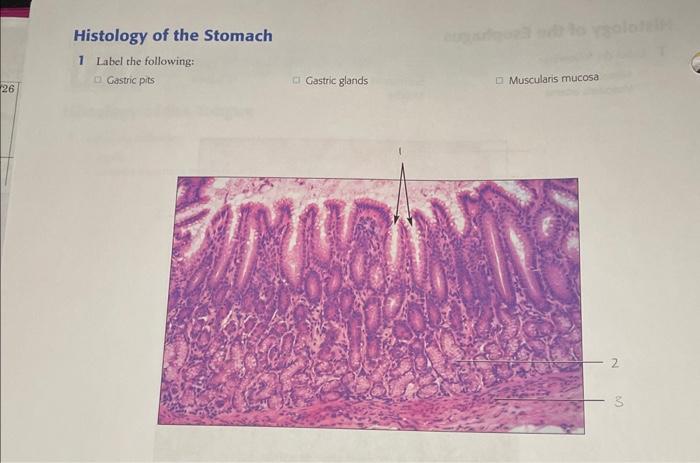 Solved Histology of the Stomach 1 Label the following: ca | Chegg.com
