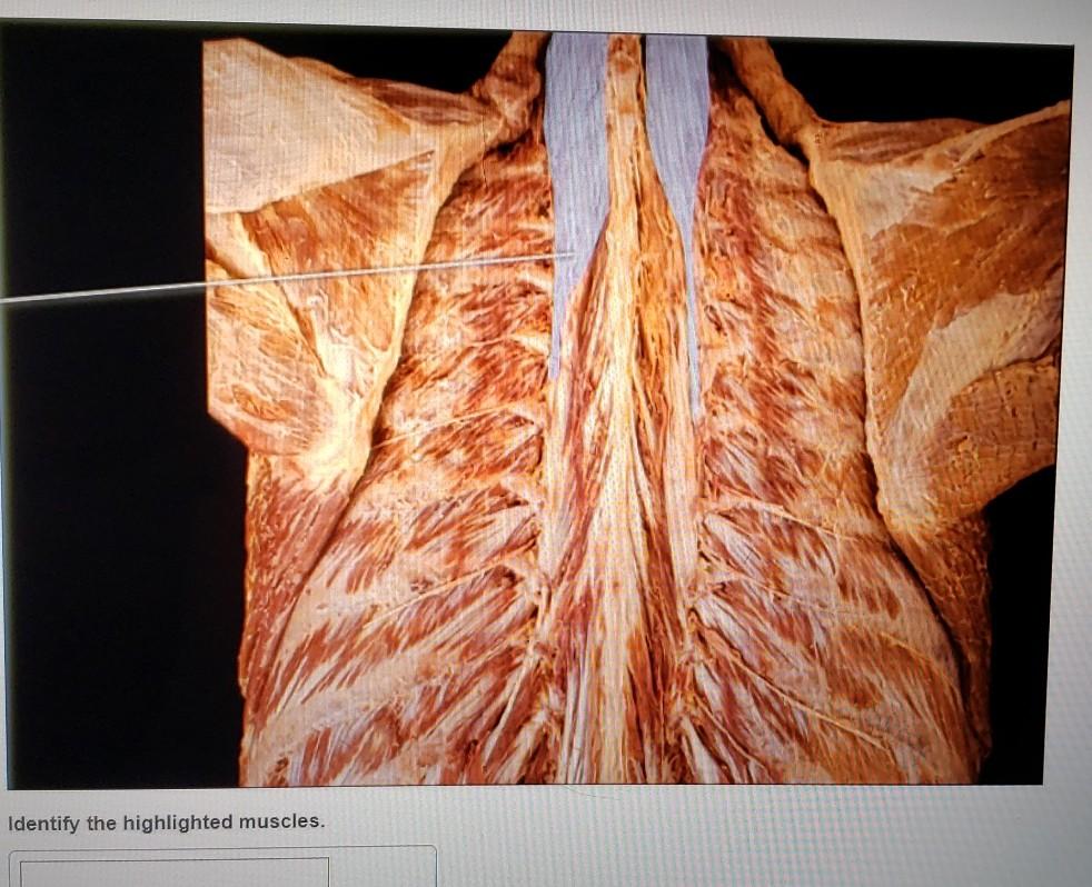 Solved Identify the highlighted muscle. Identify the | Chegg.com