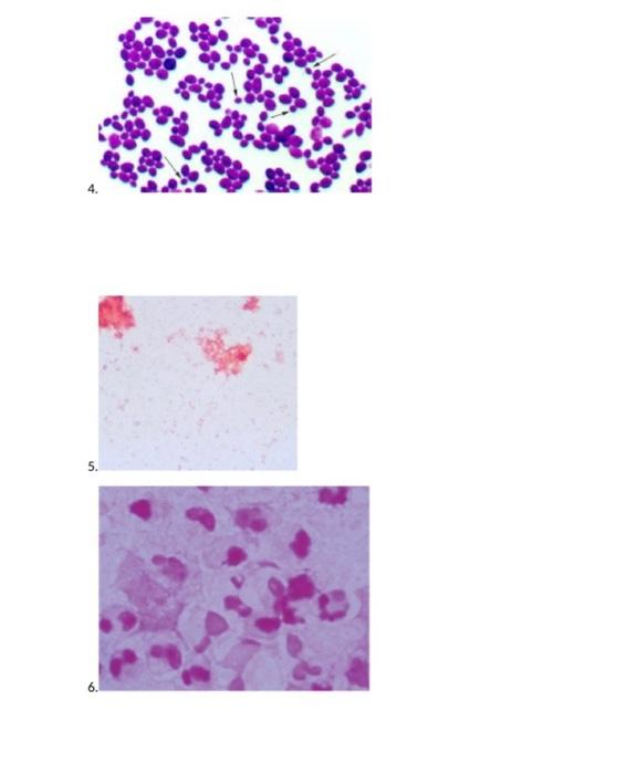 Solved Microbiology: Identify the following types of | Chegg.com