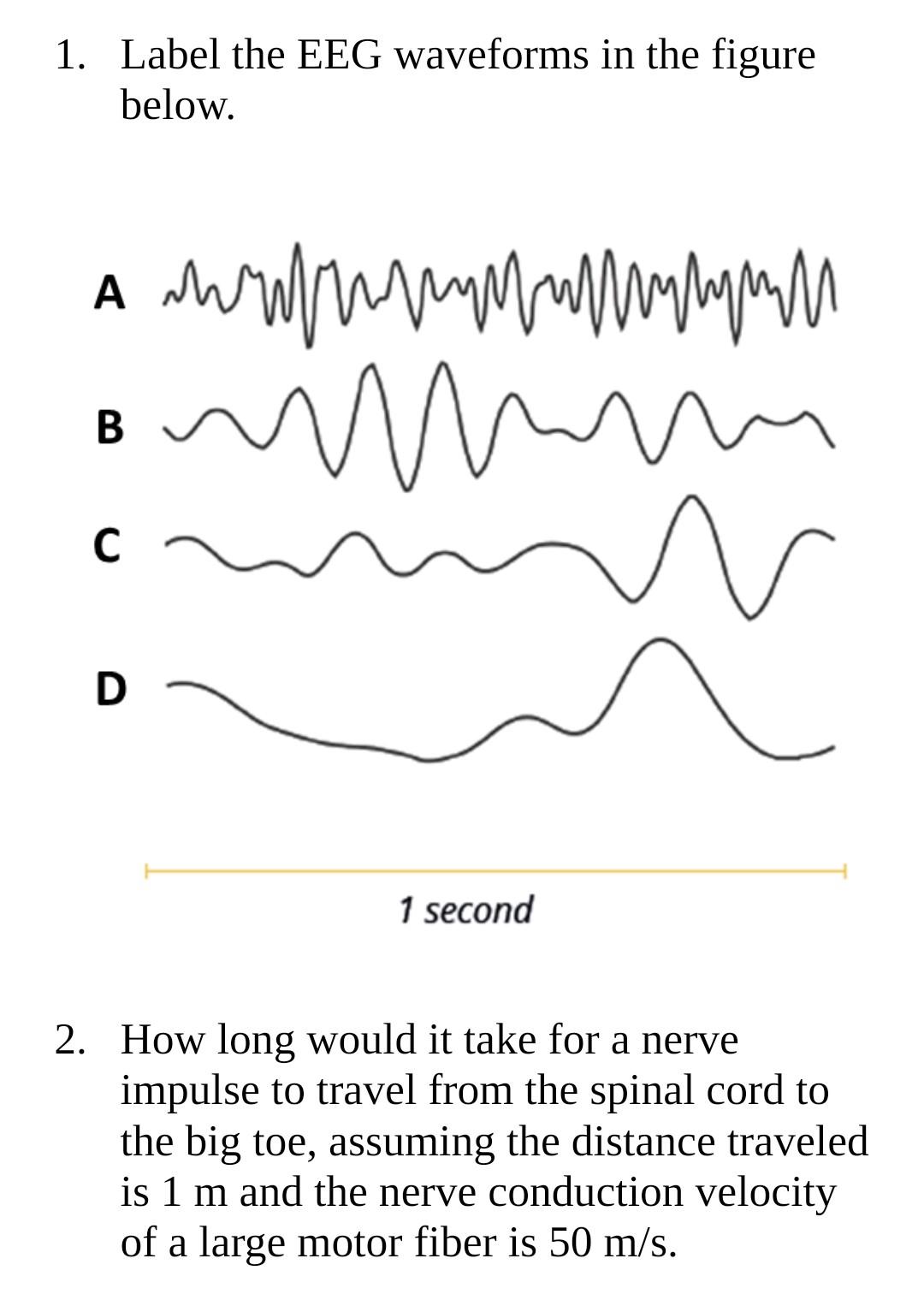 Solved 1. Label the EEG waveforms in the figure below. A | Chegg.com