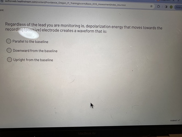 Solved Regardless of the lead you are monitoring in, | Chegg.com