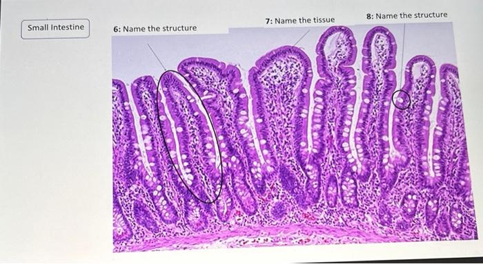 Solved Name the layers of the small intes Higher | Chegg.com