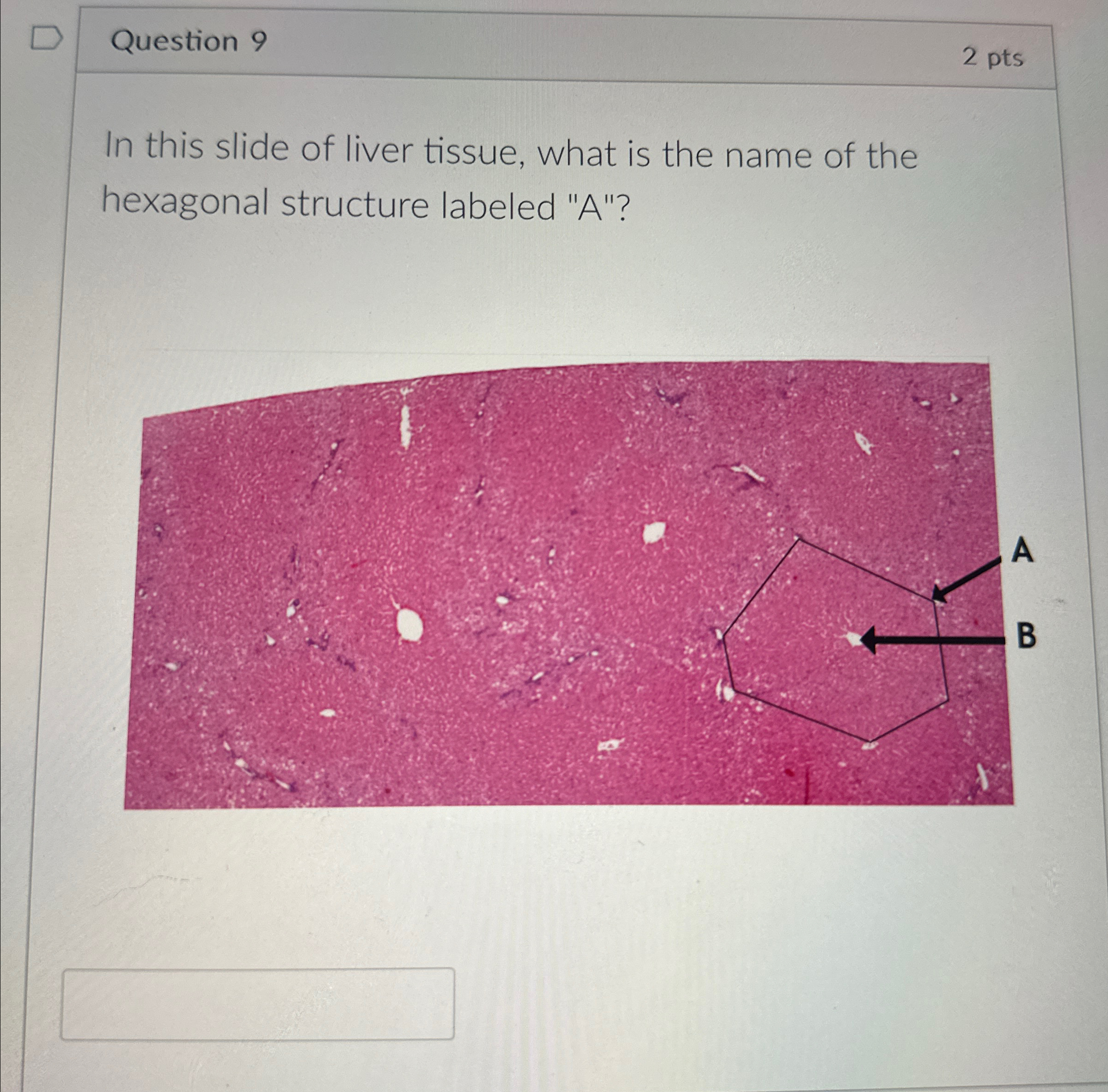Solved Question 92 ﻿ptsIn this slide of liver tissue, what | Chegg.com