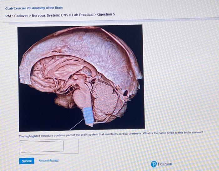 Solved Nervous System: CNS > Quiz > Question 19 Which | Chegg.com