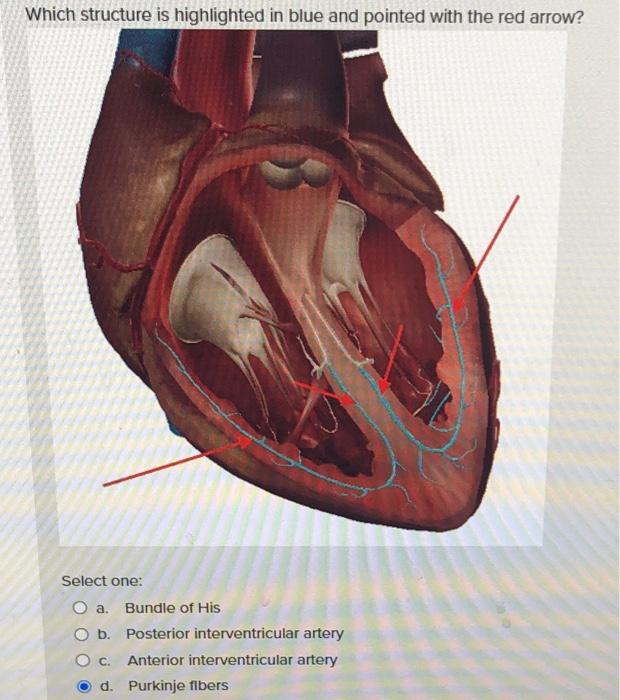 Solved Identify the left atrium of the heart. A D Select | Chegg.com
