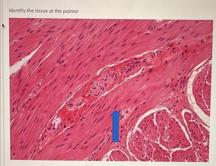 Solved Identify the tissue at the pointer Identify the | Chegg.com