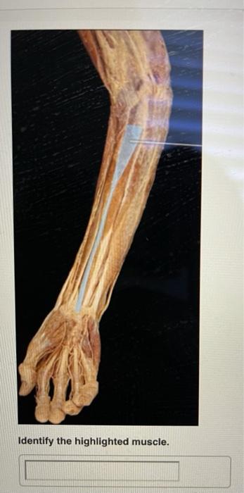 Solved Identify the highlighted muscle. The highlighted | Chegg.com