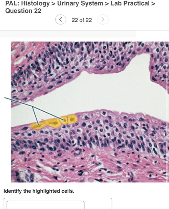 Solved PAL: Histology > Urinary System > Lab Practical > | Chegg.com