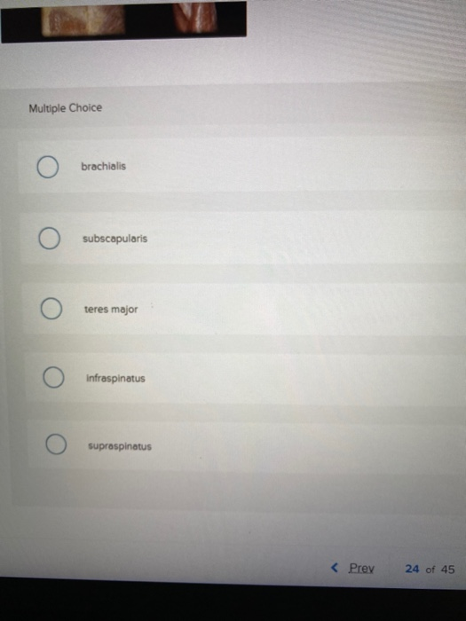 Solved Which structure is highlighted? Multiple Choice О O | Chegg.com