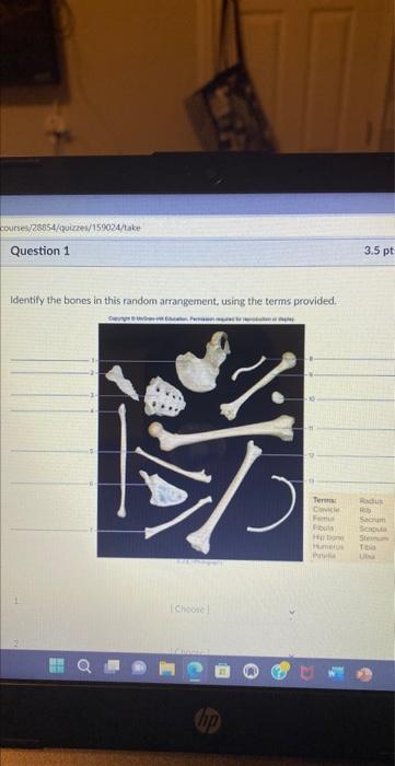 Solved Identify the bones in this random arrangement, using | Chegg.com