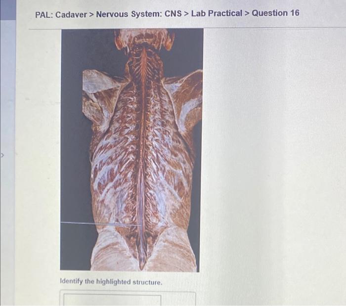 PAL: Models > Nervous System - CNS > Lab Practical > | Chegg.com