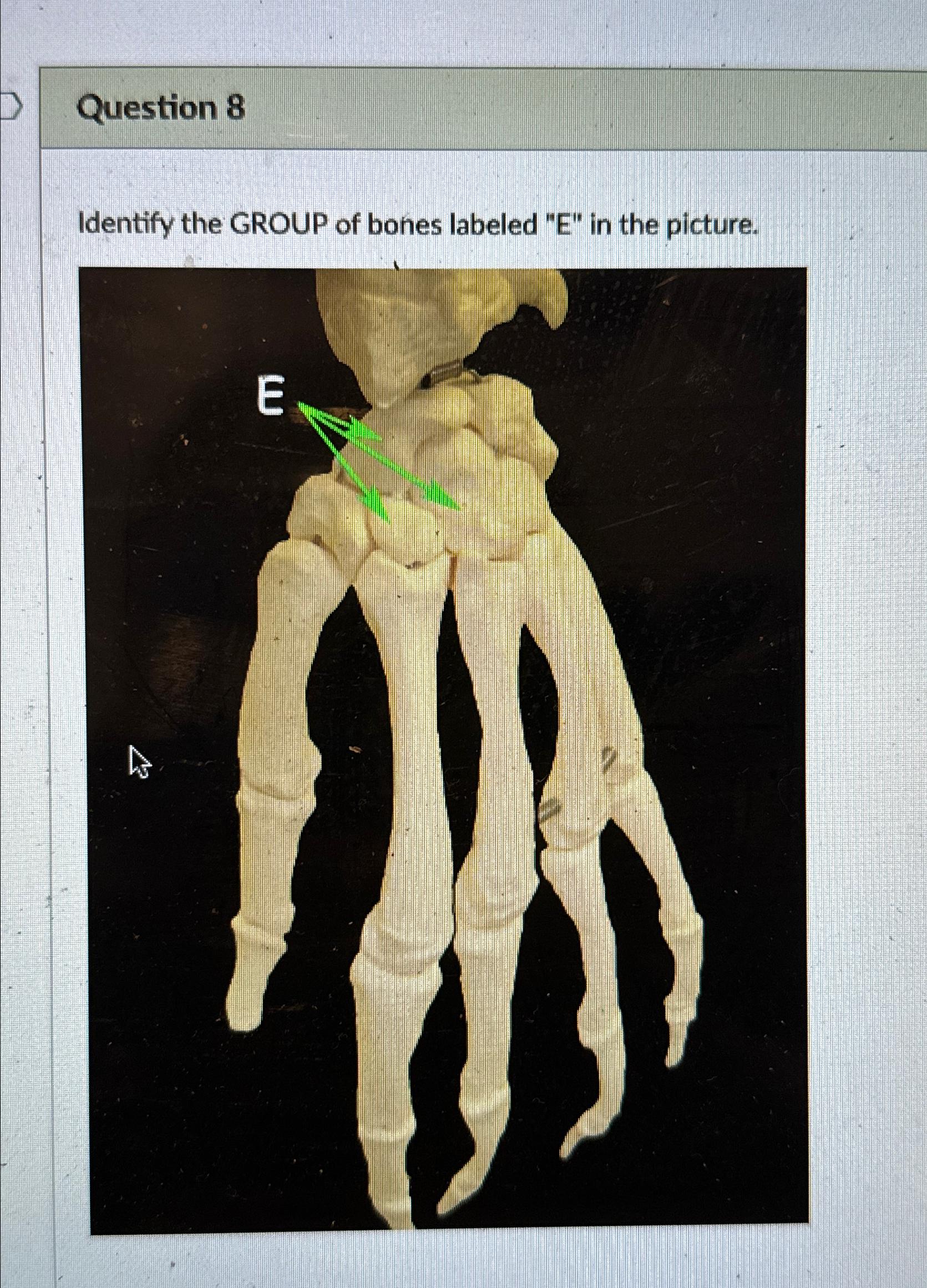 Solved Question 8Identify the GROUP of bones labeled " E " | Chegg.com