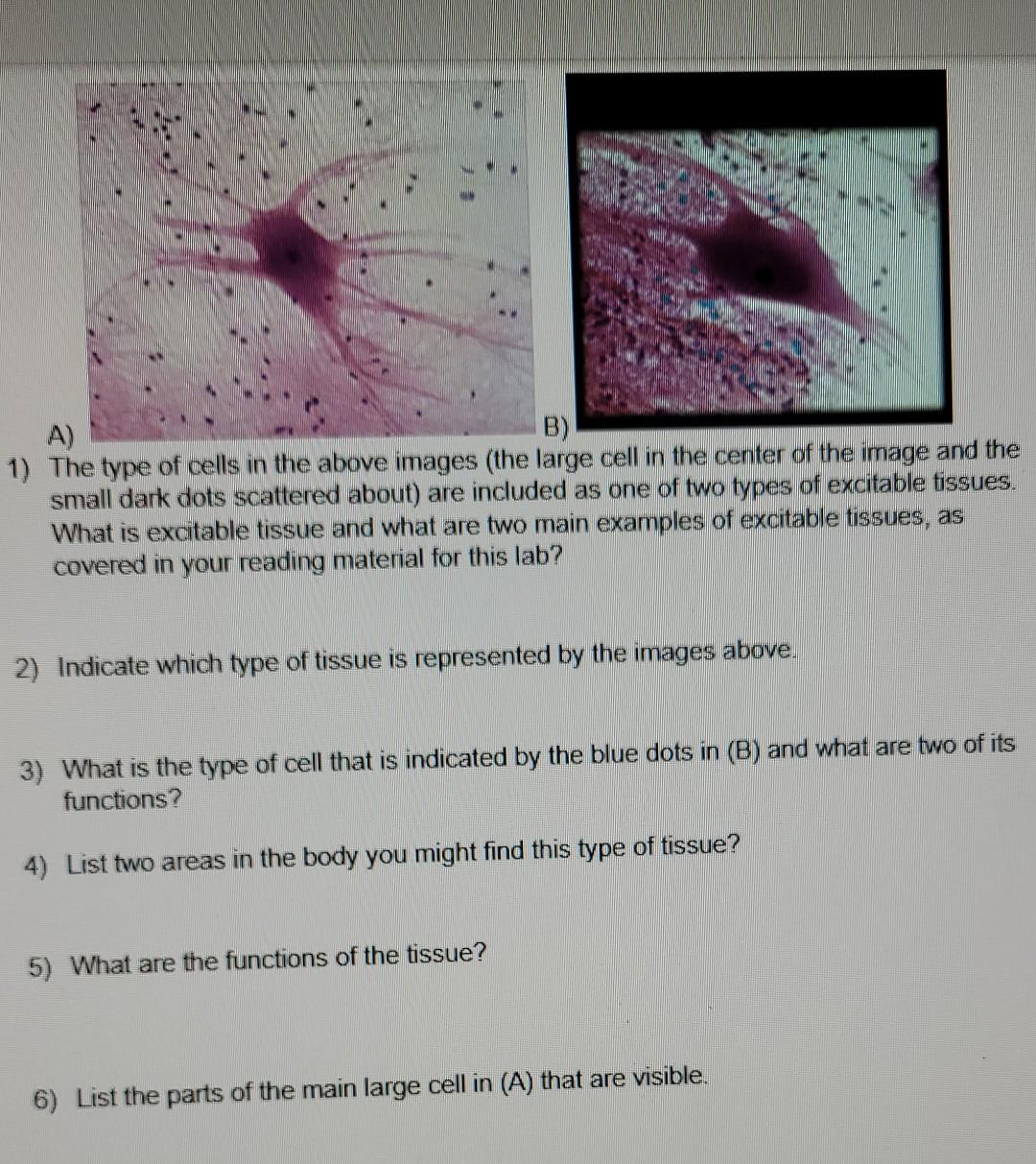 Solved A) B) 1) The type of cells in the above images (the | Chegg.com