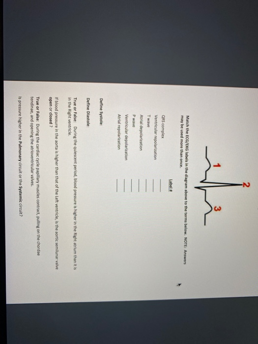 Solved the Match the ECG/EKG labels in the diagram above to | Chegg.com