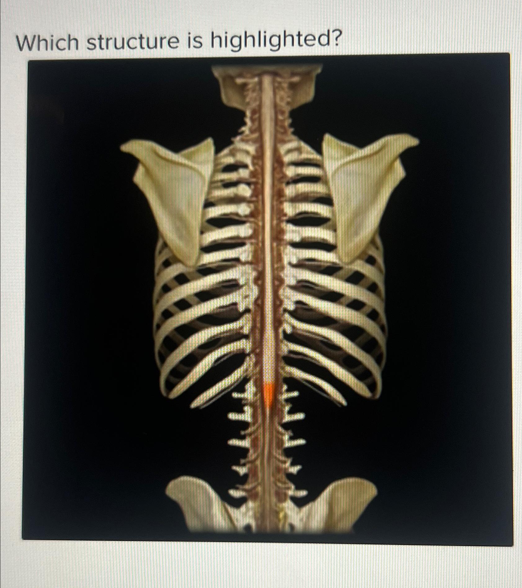 Solved Which structure is highlighted? | Chegg.com
